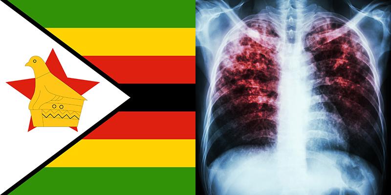 Tuberculosis in Zimbabwe